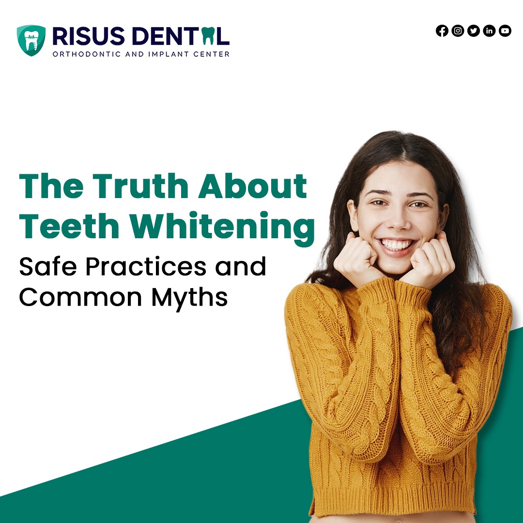 The Truth About Teeth Whitening | Risus Dental