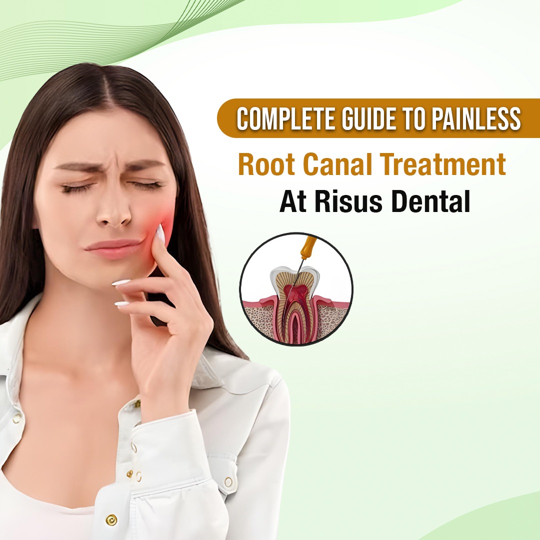 Complete Guide to Painless Root Canal Treatment at Risus Dental