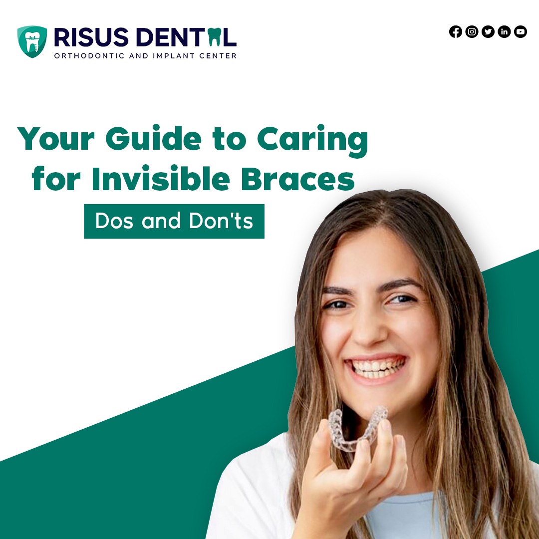 Essential Guide to Caring for Invisible braces | Risus Dental | Nagaram