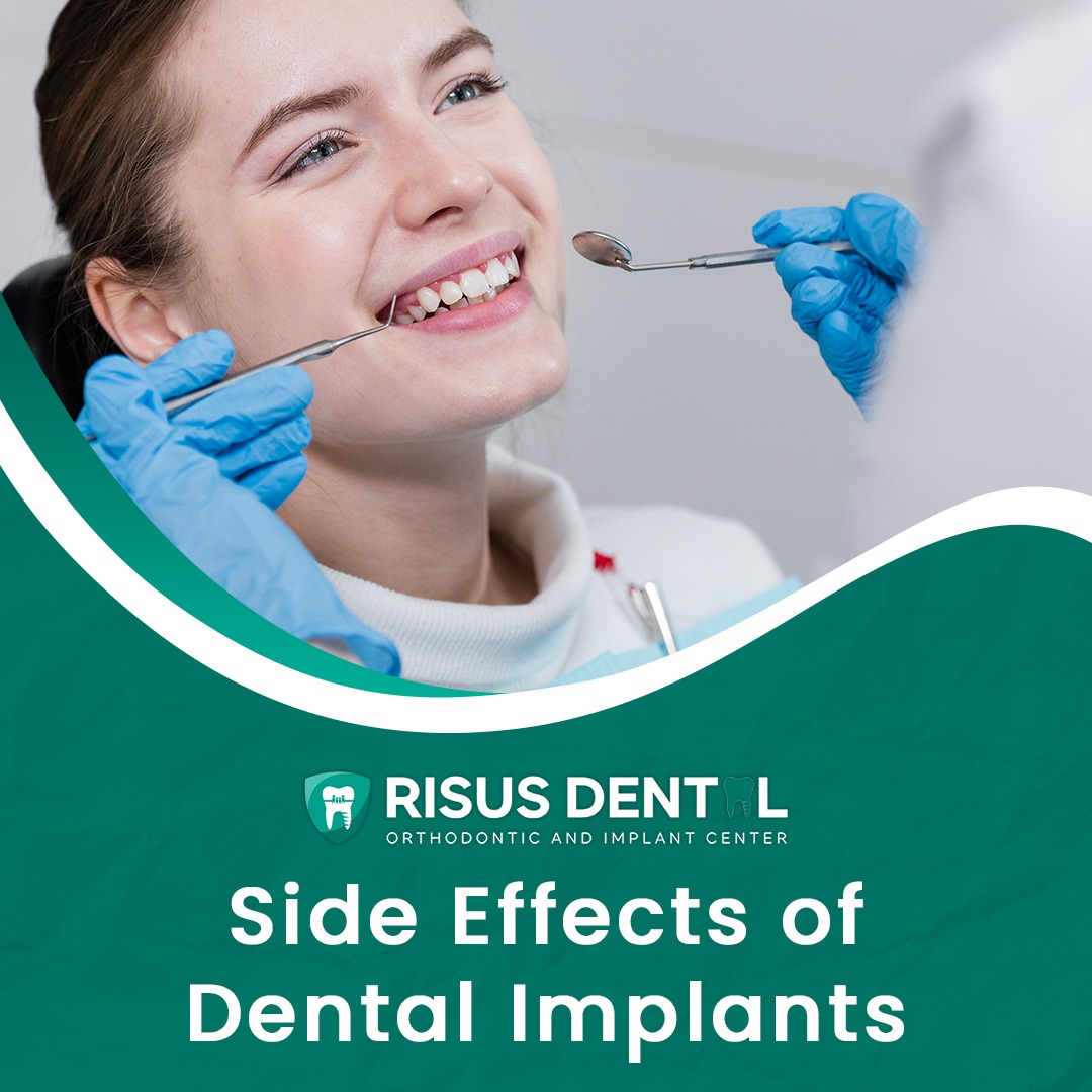 Common Side Effects of Dental Implants: What You Need to Know