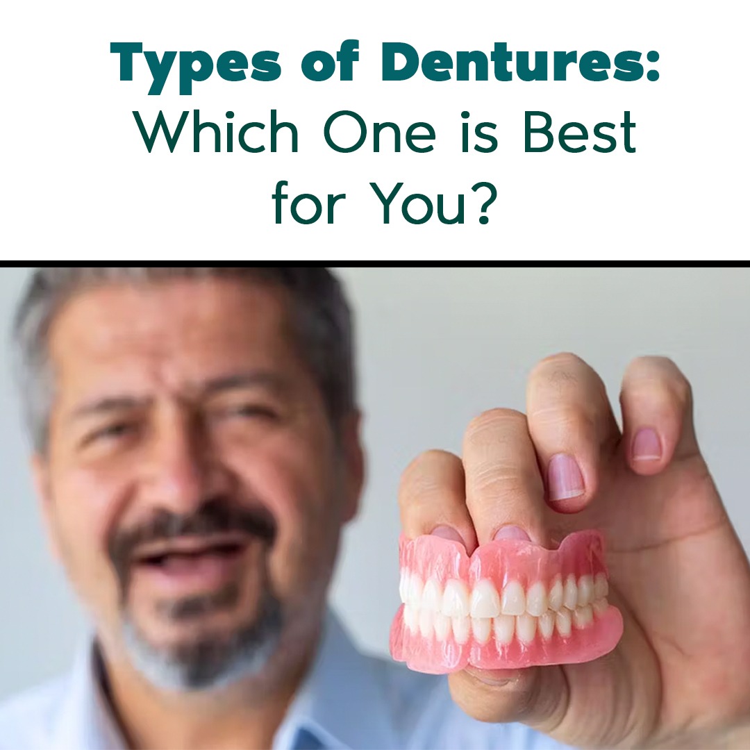 Types of Dentures: Find Your Perfect Fit at Risus Dental for a Healthy ...