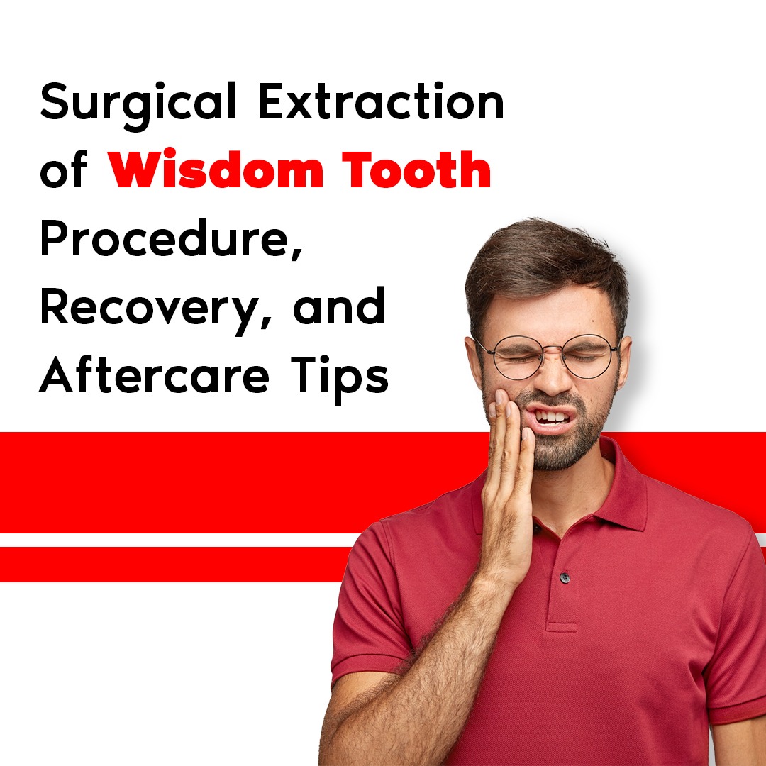Surgical Extraction of Wisdom Tooth: Procedure, Recovery, and Aftercare ...