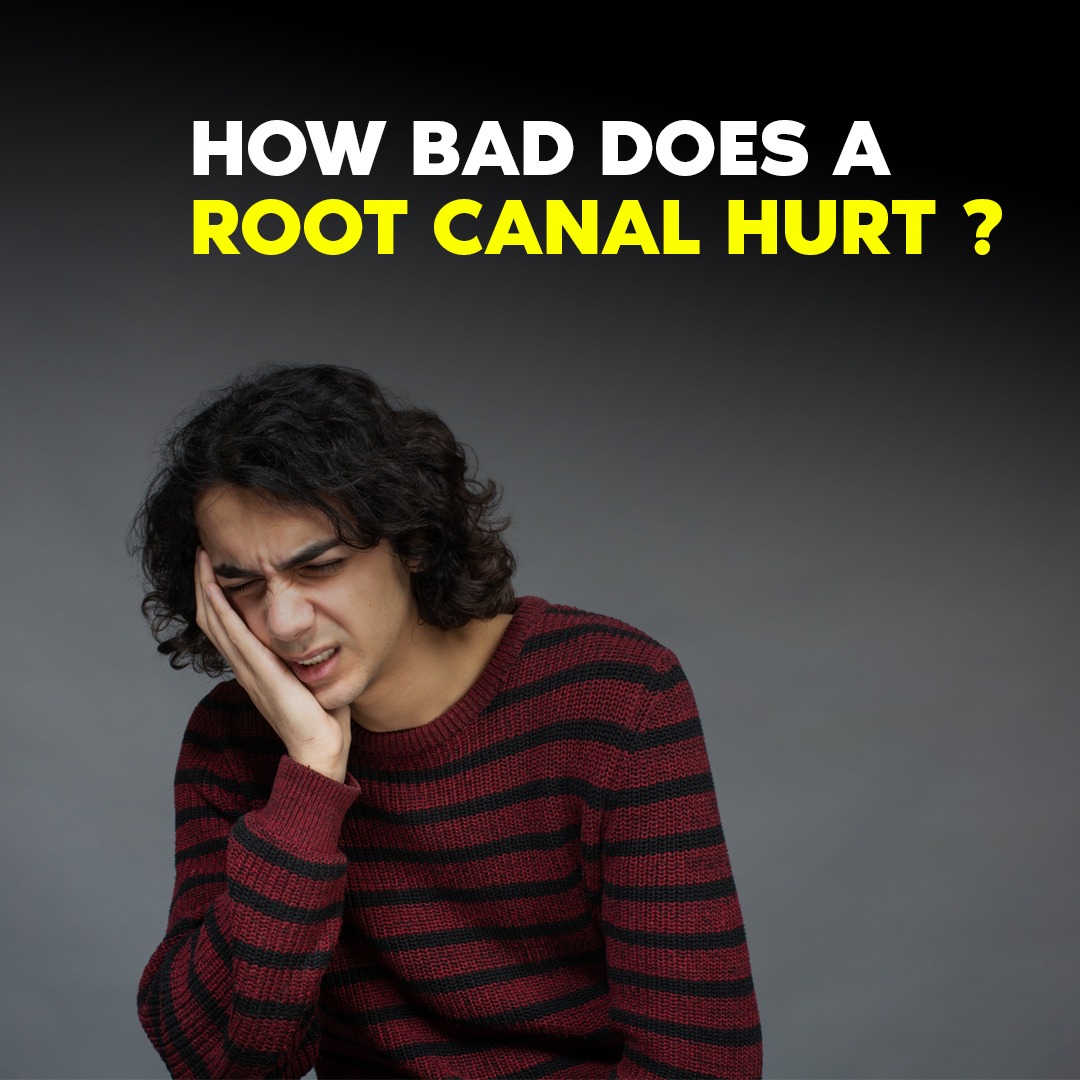 How bad does a root canal hurt? - Risus Dental Clinic